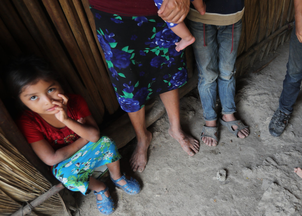 Guatemala, la niña desnutrida - Con Criterio